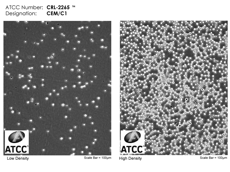 CEM/C1细胞ATCC CRL-2265细胞 CEMC1人急性淋巴细胞白血病细胞株购买价格、培养基、培养条件、细胞图片、特征等基本信息_生物风