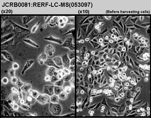 RERF-LC-MS细胞 RERFLCMS人肺癌腺癌细胞株购买价格、培养基、培养条件、细胞图片、特征等基本信息_生物风