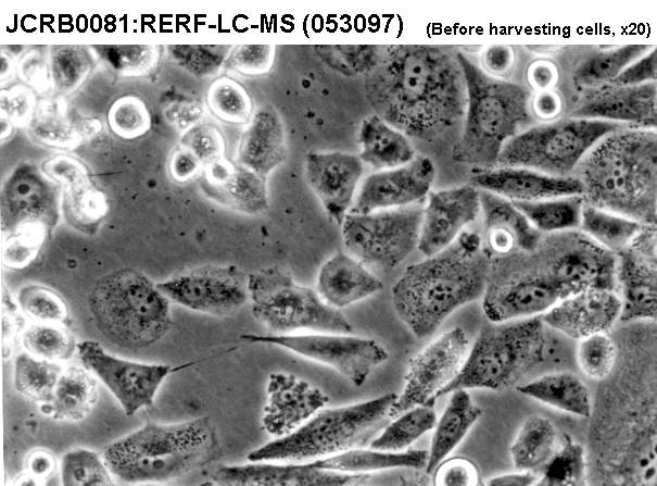 RERF-LC-MS细胞 RERFLCMS人肺癌腺癌细胞株购买价格、培养基、培养条件、细胞图片、特征等基本信息_生物风
